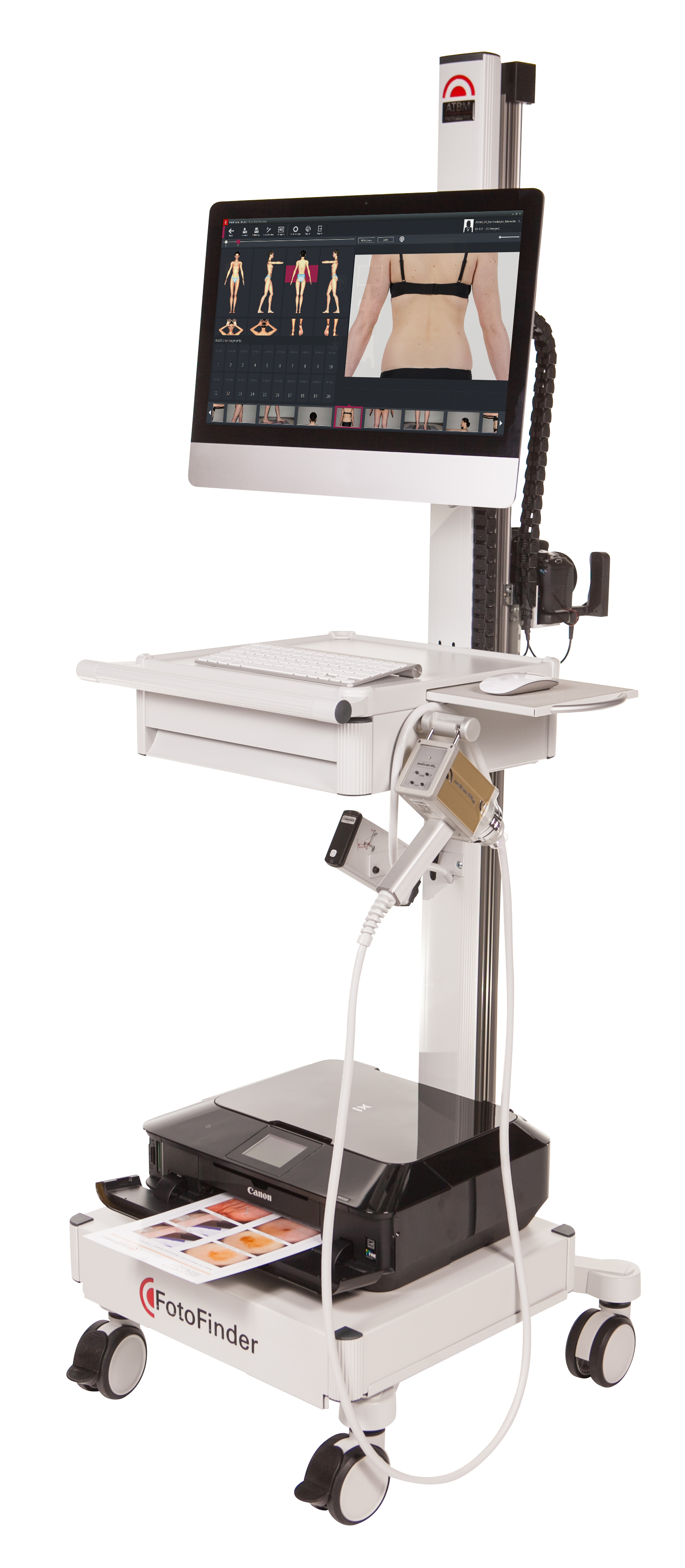 FotoFinder bodystudio ATBM / Оборудование и методики / О клинике ...